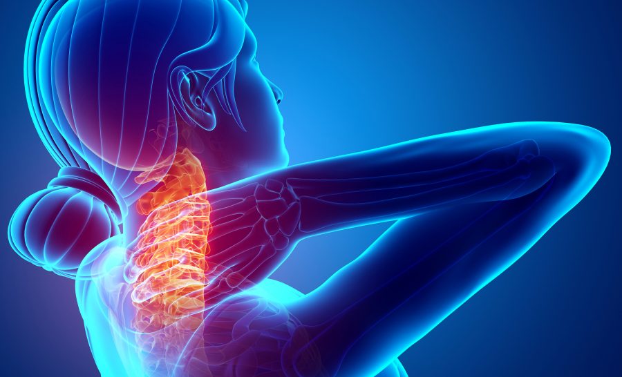 Nekhernia? Een operatie is te voorkomen! - ForYou Magazine